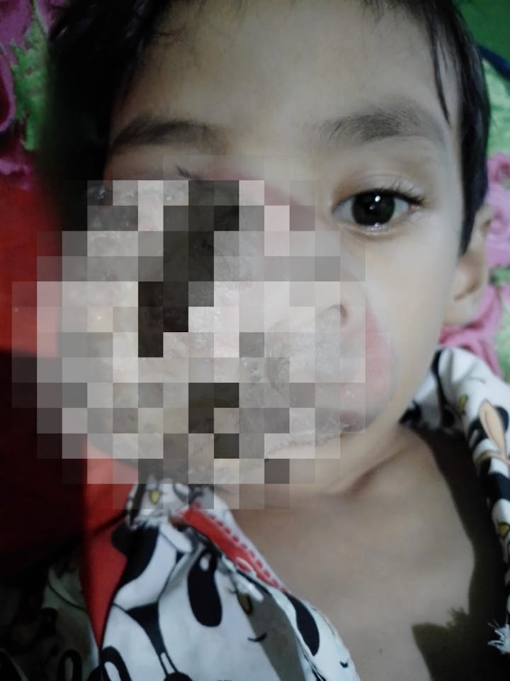 MENDESAK ! Kini Terkendala Biaya! Bantu Zakki Bisa Lanjutkan Kemoterapi