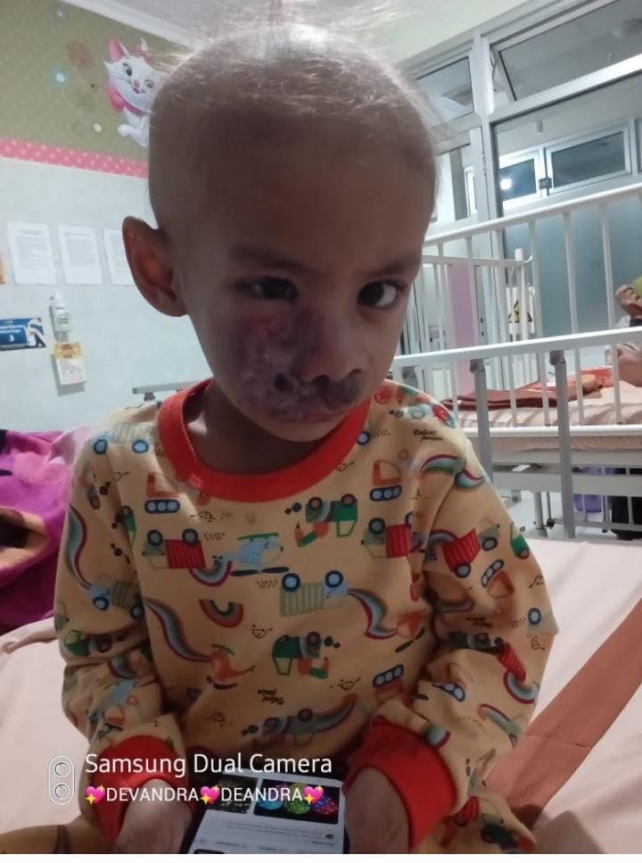 MENDESAK ! Kini Terkendala Biaya! Bantu Zakki Bisa Lanjutkan Kemoterapi