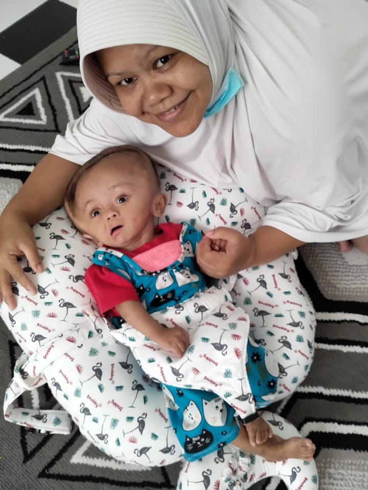 Bantu Neng Siti anak kuli panggul menyidap penyakit Hydrocepalus dan ...