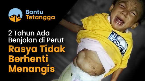 3x Operasi Benjolan di Perut Semakin Membesar, Rasya Ingin Sembuh