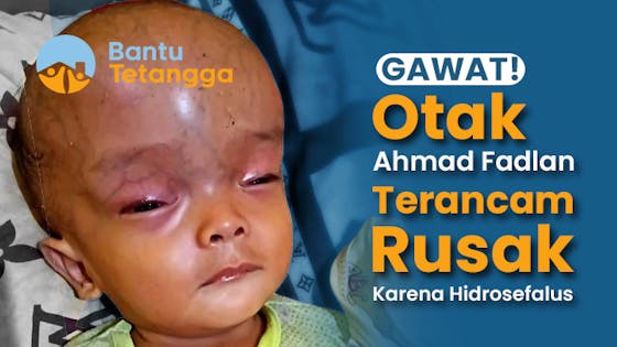 Bantu Ahmad Fadlan Sembuh dari Hidrosefalus